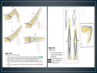 Hand anatomy- harsh amin | PPTX