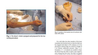 Hand and Upper limb Anatomy related to hand transplantation | PPTX