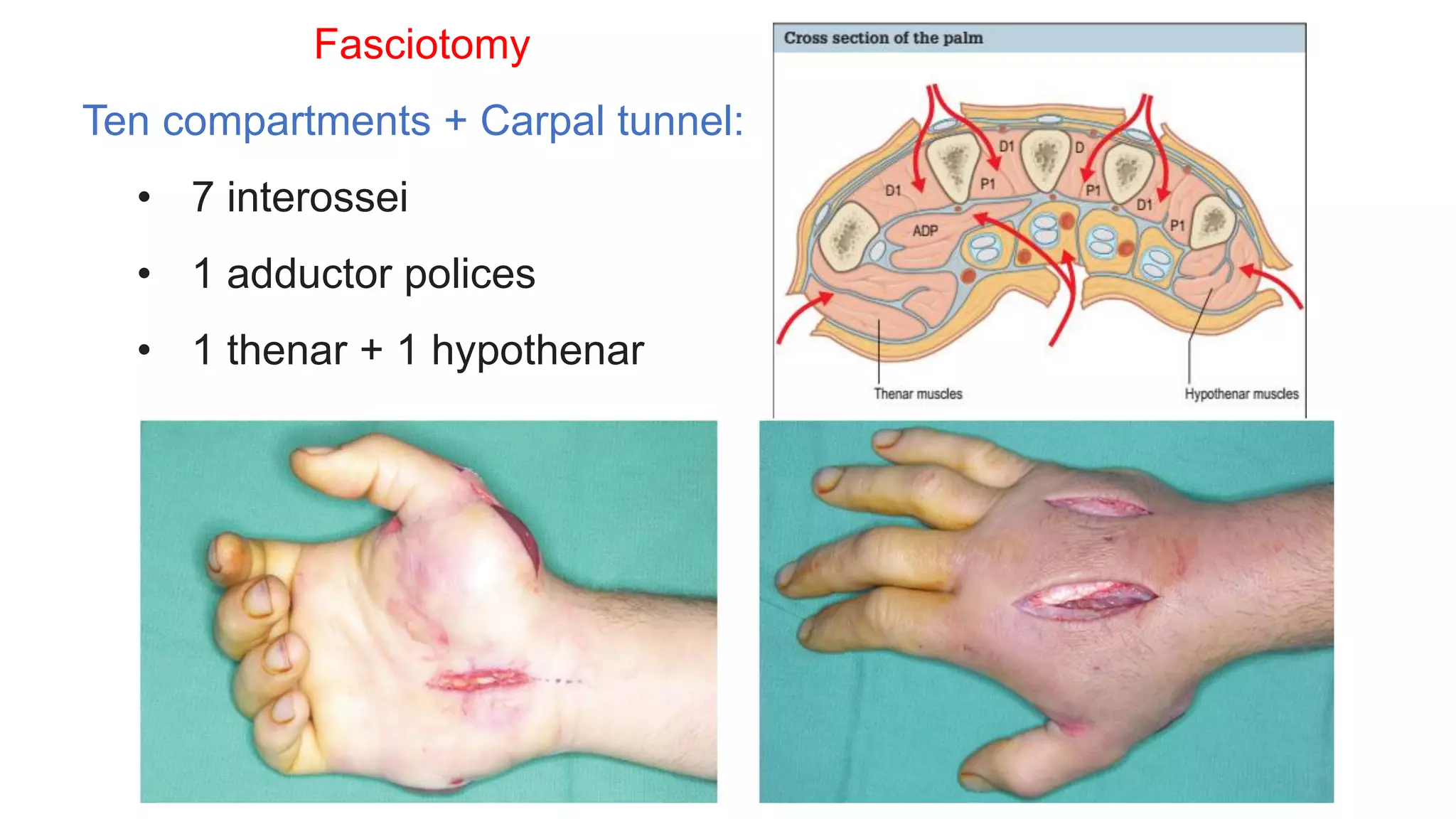 Hand anatomy 1 | PDF