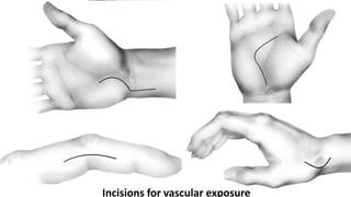 Hand anatomy 1 | PDF