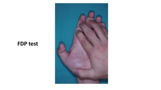 Hand anatomy 1 | PDF
