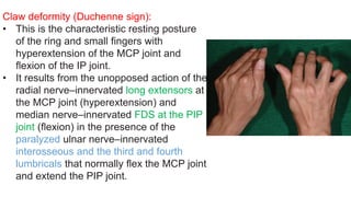 Hand anatomy 2 | PDF