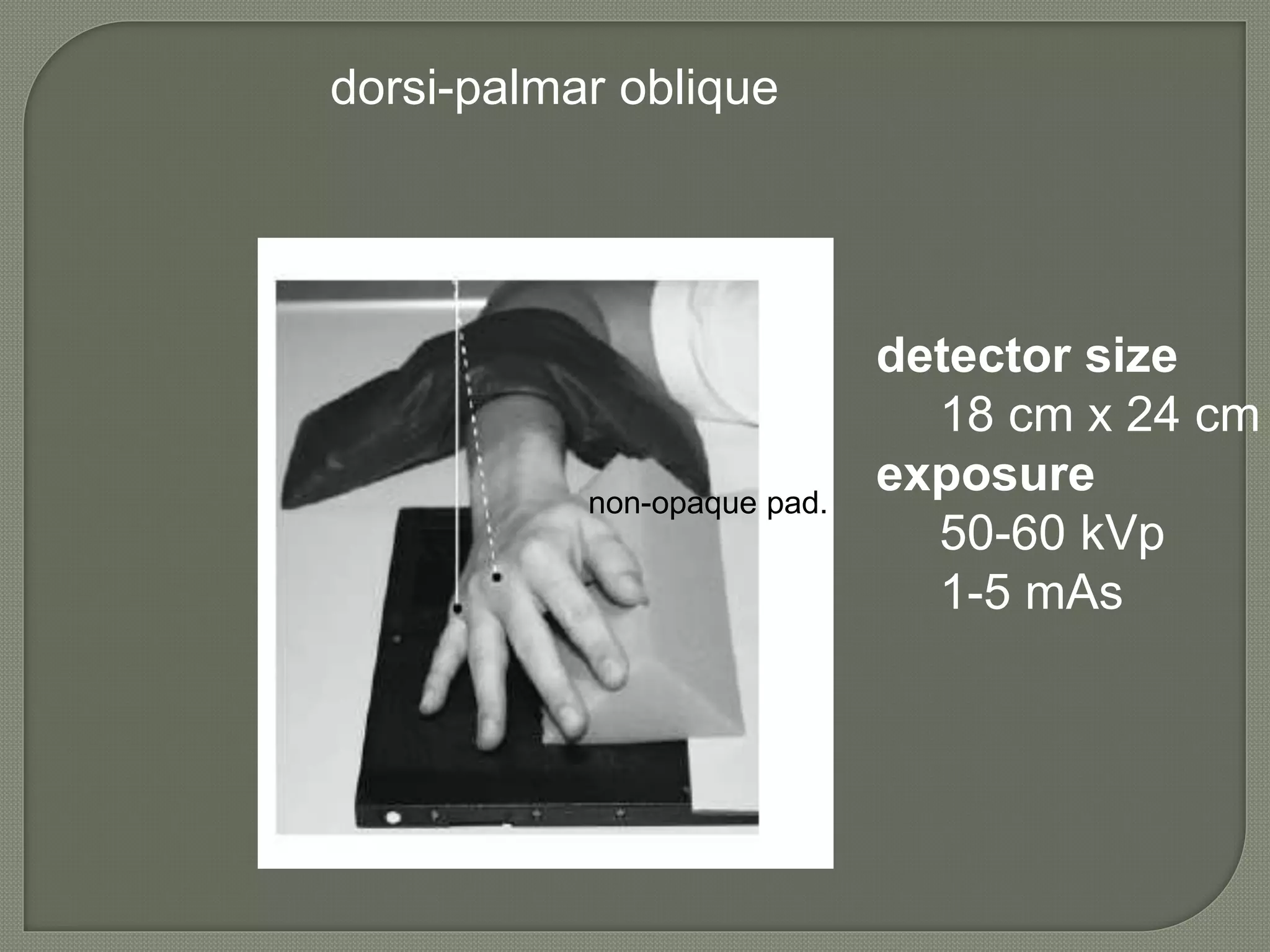 Hand and fore arm radiology truma girish gunar | PPTX