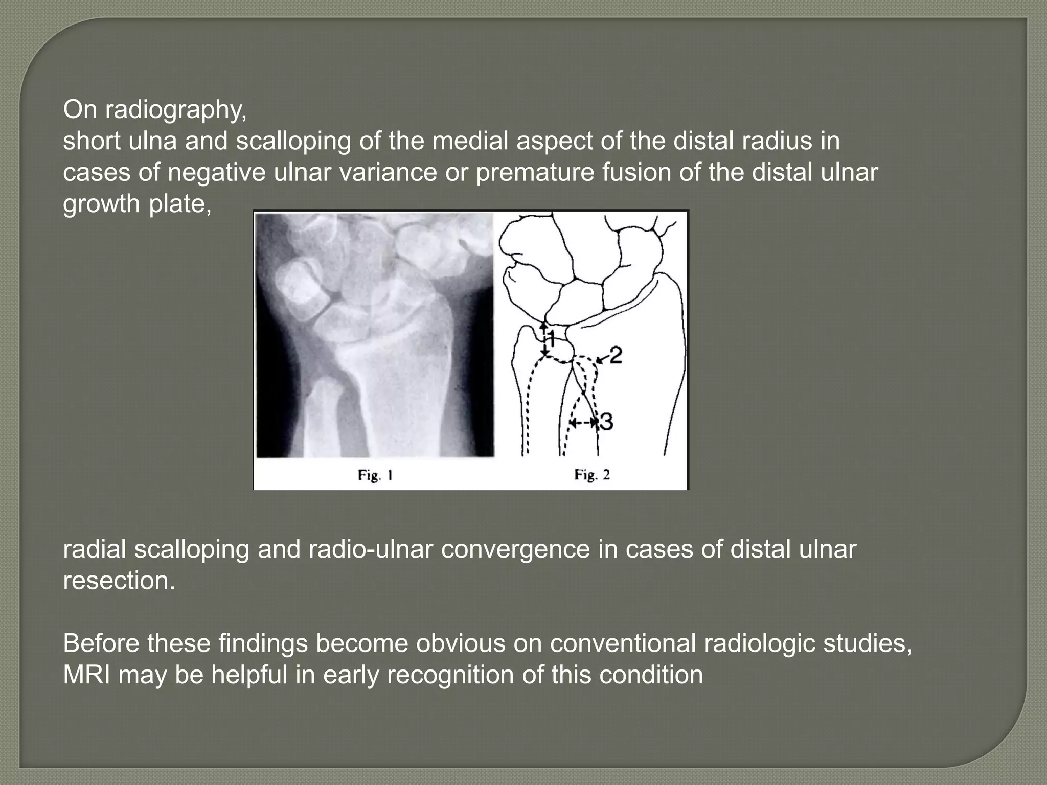 Hand and fore arm radiology truma girish gunar | PPT