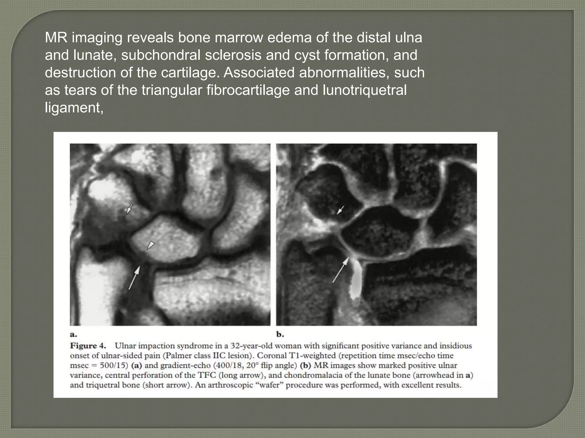 Hand and fore arm radiology truma girish gunar | PPTX