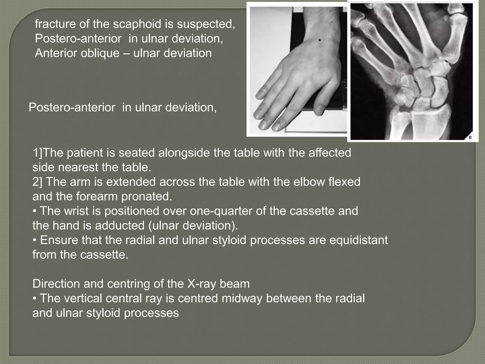 Hand and fore arm radiology truma girish gunar | PPTX