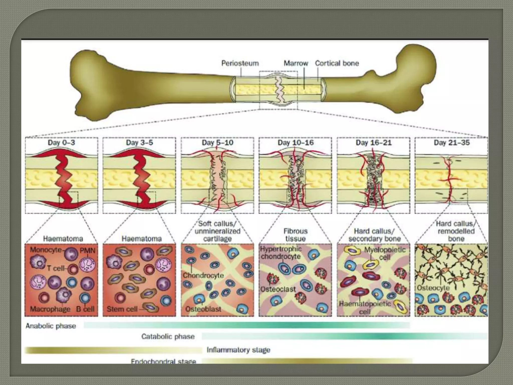 Hand and fore arm radiology truma girish gunar | PPTX