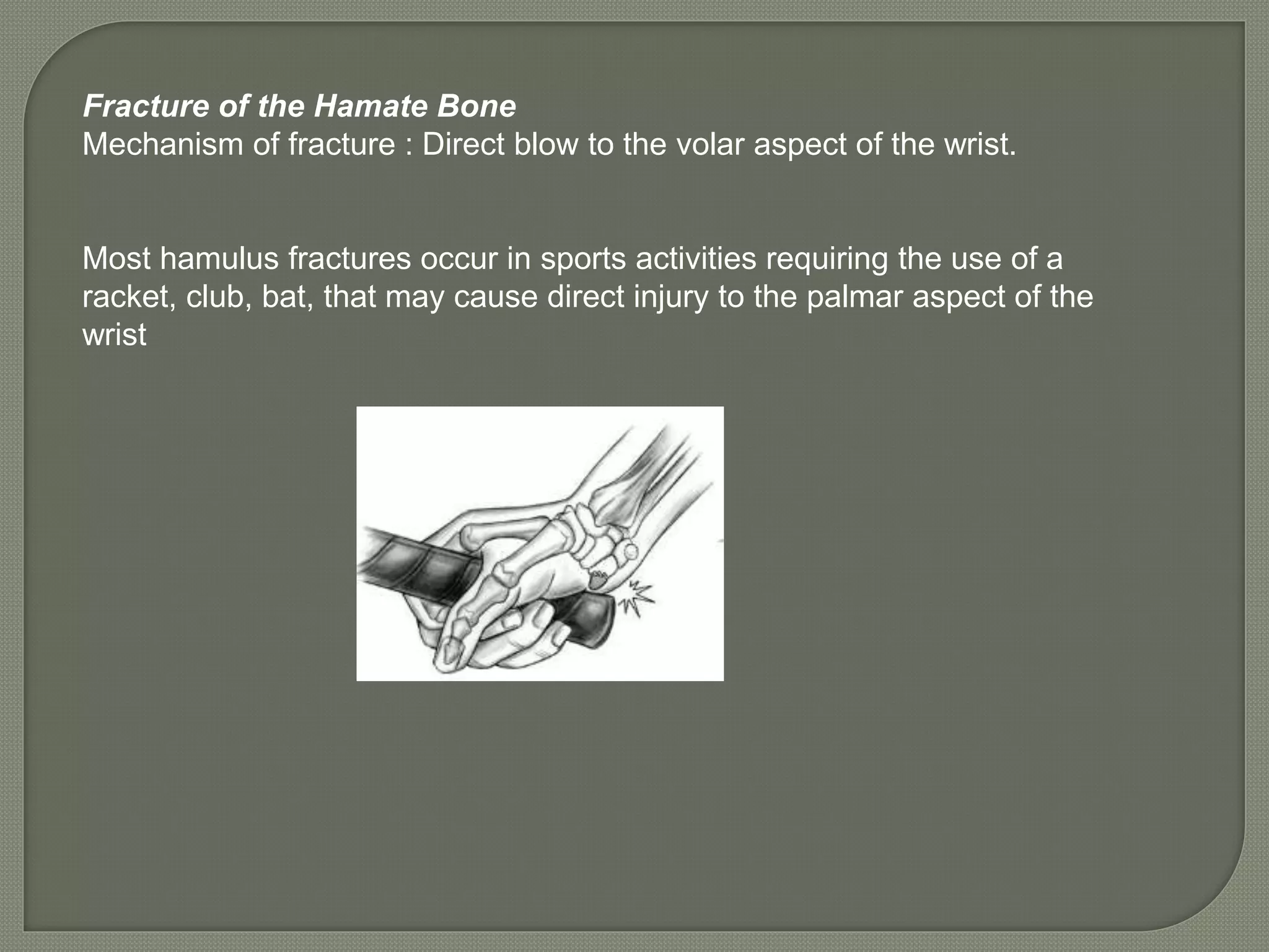 Hand and fore arm radiology truma girish gunar | PPTX
