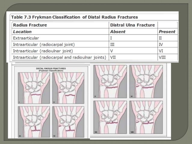 Hand and fore arm radiology truma girish gunar | PPT