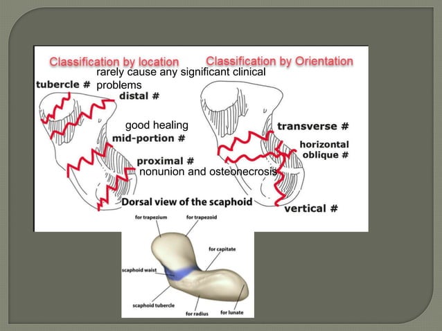 Hand and fore arm radiology truma girish gunar | PPT