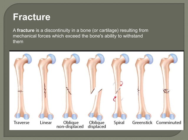 Hand and fore arm radiology truma girish gunar | PPT