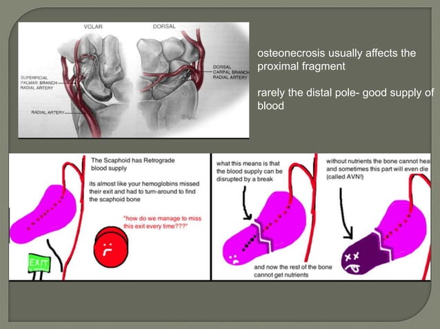 Hand and fore arm radiology truma girish gunar | PPT | Free Download