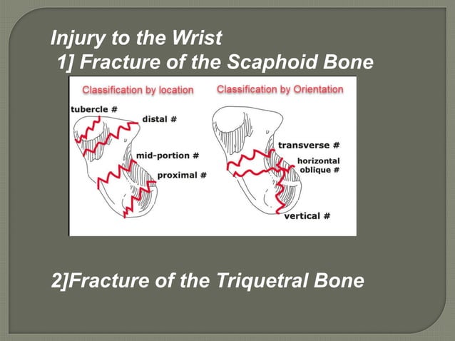 Hand and fore arm radiology truma girish gunar | PPT