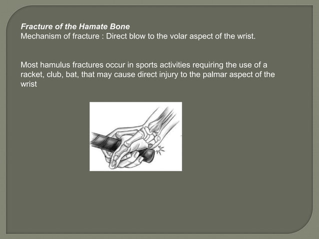 Hand and fore arm radiology truma girish gunar | PPT