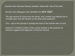 Hand and fore arm radiology truma girish gunar | PPTX