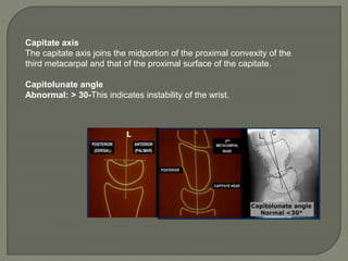 Hand and fore arm radiology truma girish gunar | PPTX
