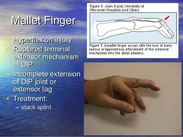 Handand wristexam
