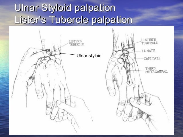 Ulnar Styloid Process Palpation