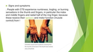 Hand and wrist joint | PPTX