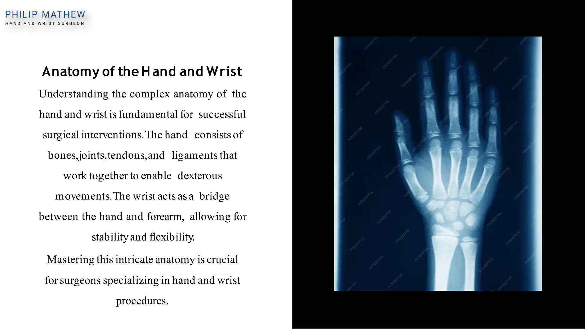 Best Hand Surgeon London | PPT