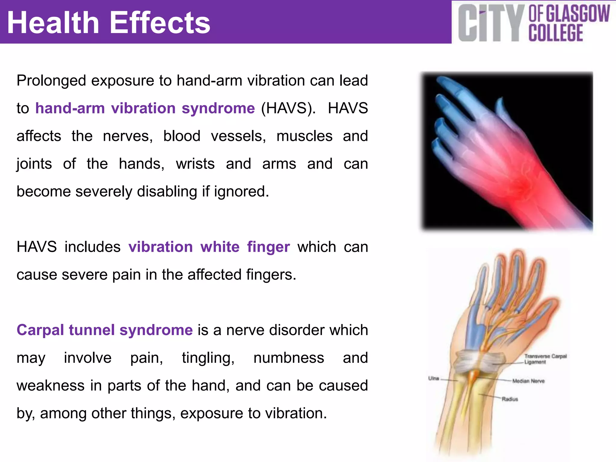 Hand Arm Vibration | PPTX