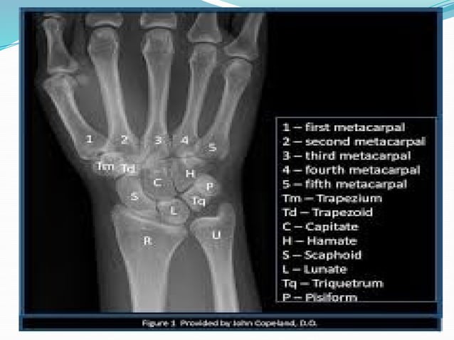 HAND assessment physiotherapy........... | PPT