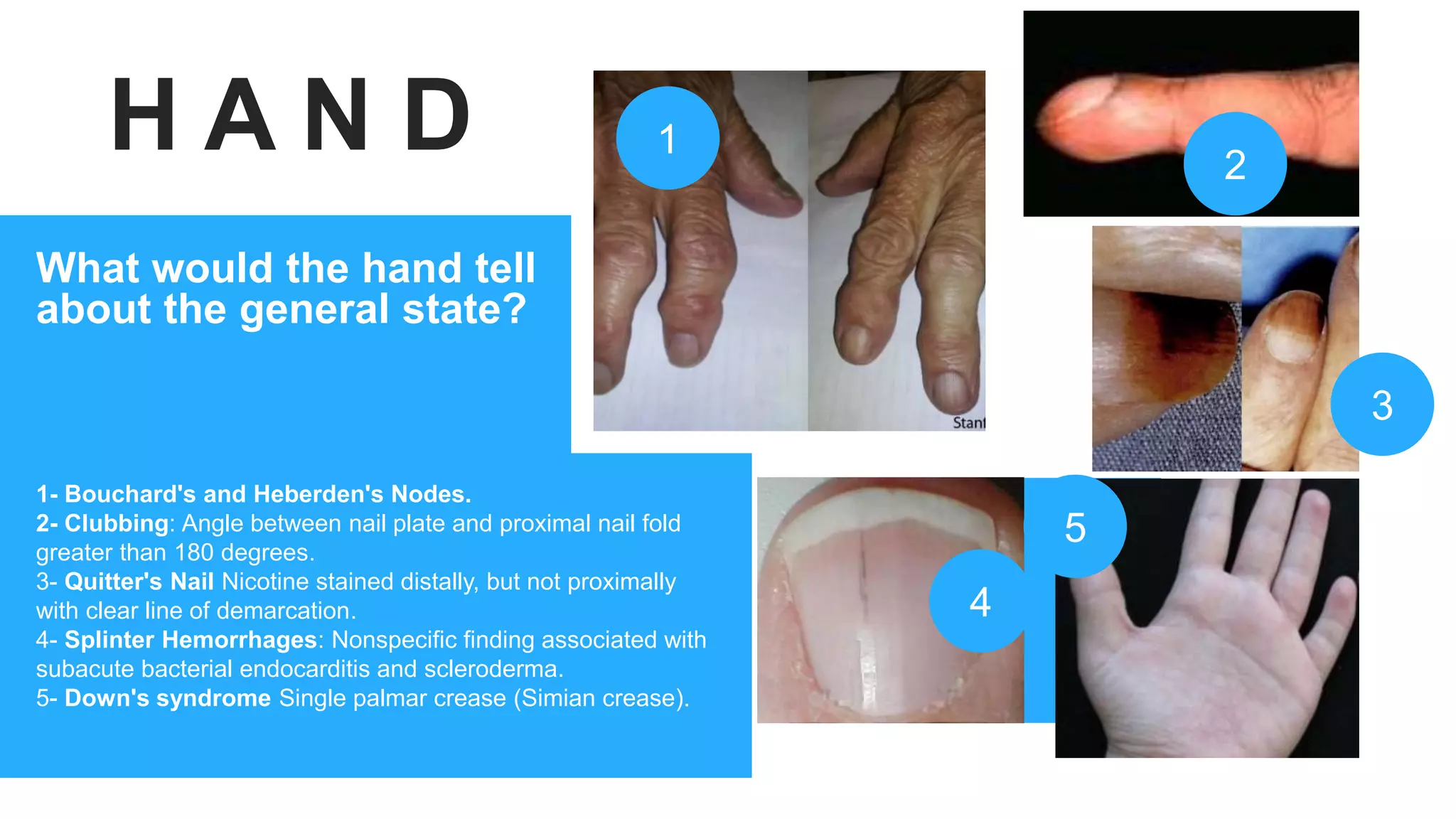 Hand anatomy and biomechanics wrist examination.pptx