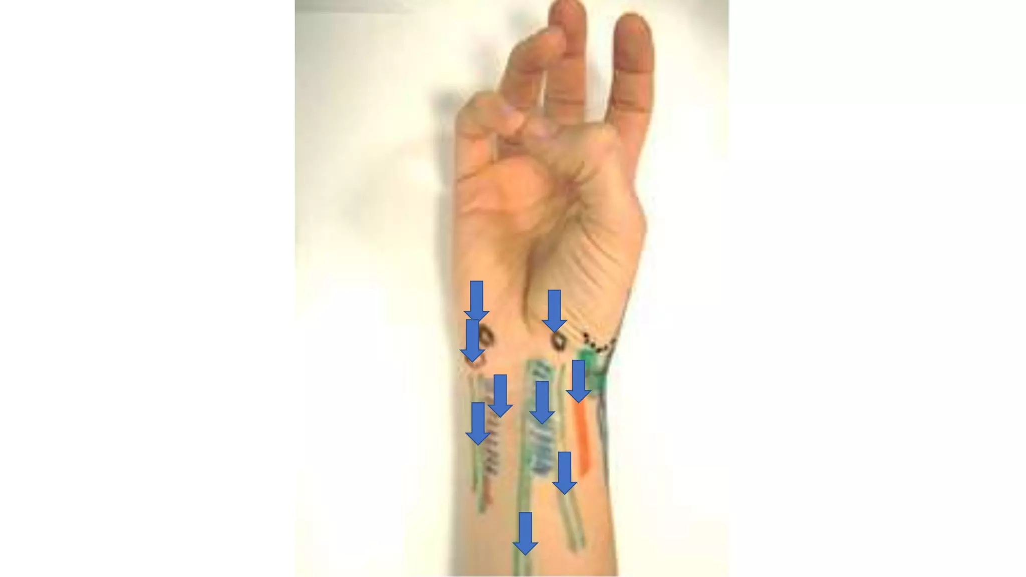Hand biomechanics and basic functions | PPTX