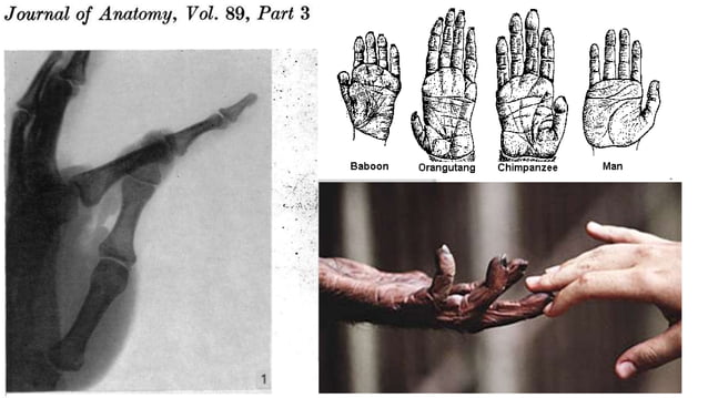 Hand biomechanics and basic functions | PPTX