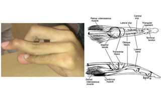 Hand biomechanics and basic functions | PPTX