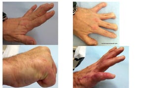 Hand biomechanics and basic functions | PPTX