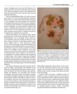 Handbook of Atopic Eczema. 2006.pdf