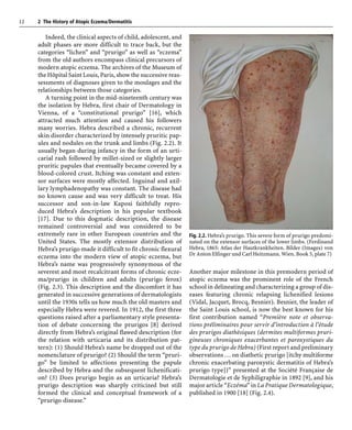 Handbook of Atopic Eczema. 2006.pdf