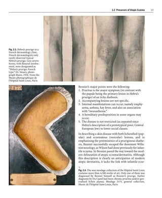 Handbook of Atopic Eczema. 2006.pdf