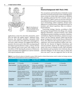 Handbook of Atopic Eczema. 2006.pdf