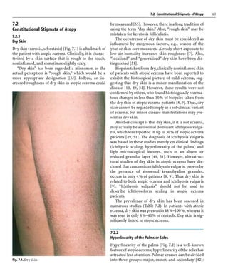 Handbook of Atopic Eczema. 2006.pdf