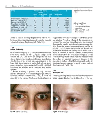 Handbook of Atopic Eczema. 2006.pdf