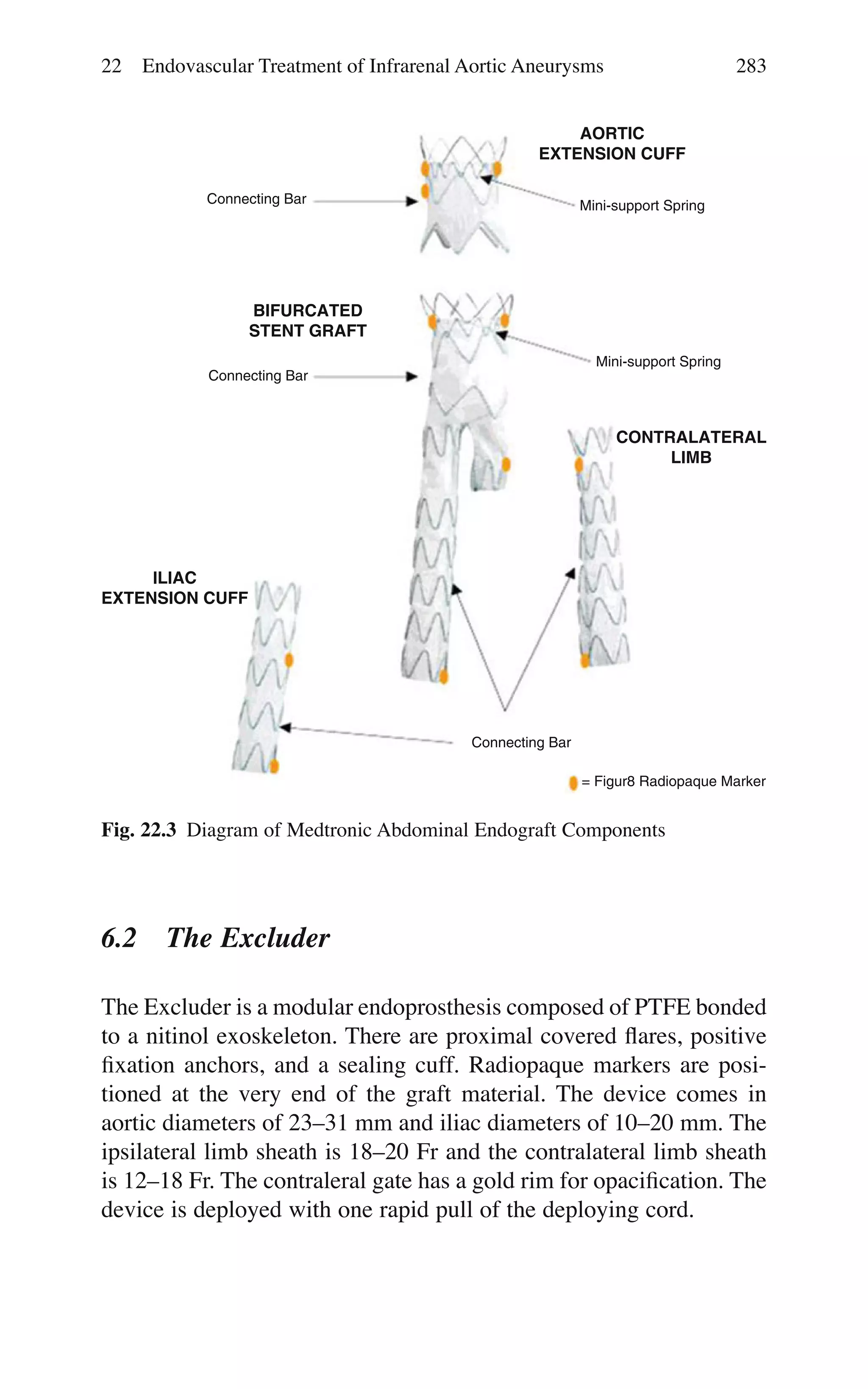 Handbook of Endovascular Interventions | PDF