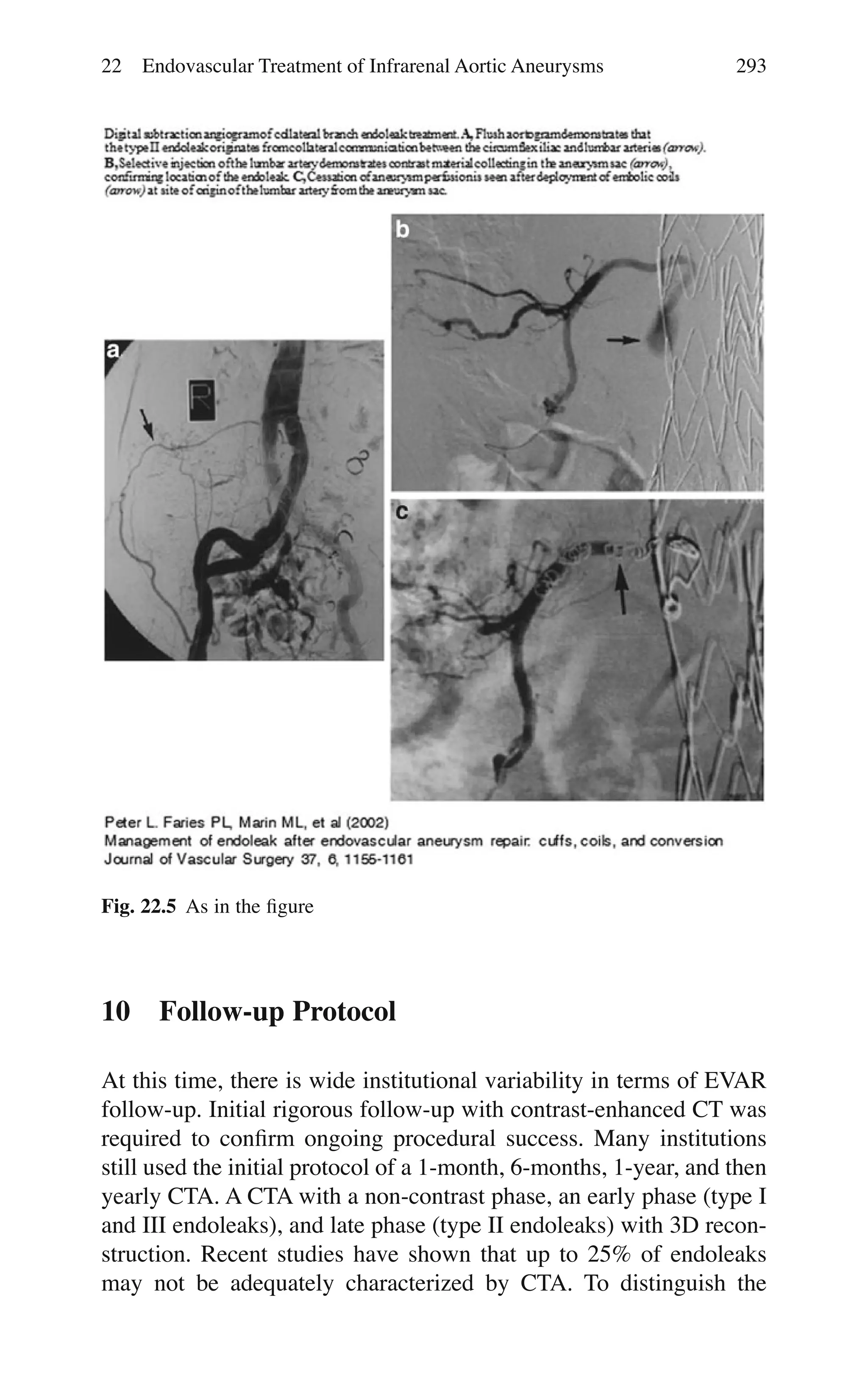 Handbook of Endovascular Interventions | PDF