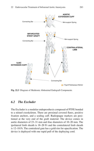 Handbook of Endovascular Interventions | PDF