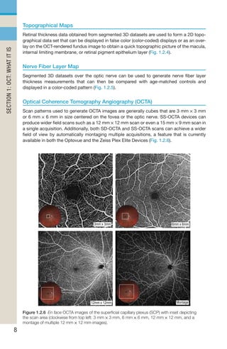 Handbook of Retinal OCT Second Edition.. | PDF