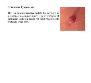 Handbook of skin diseases | PDF