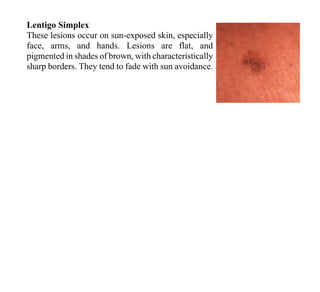 Handbook of skin diseases | PPT