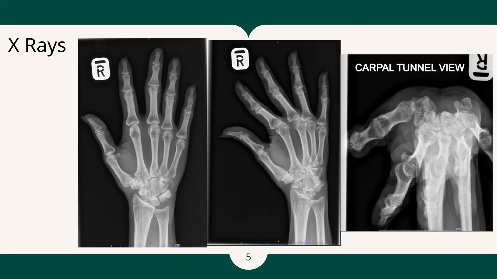 hand census microsurgery 27 Nov 24.pptx
