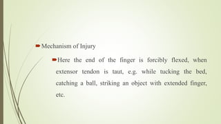 Hand deformities | PPTX