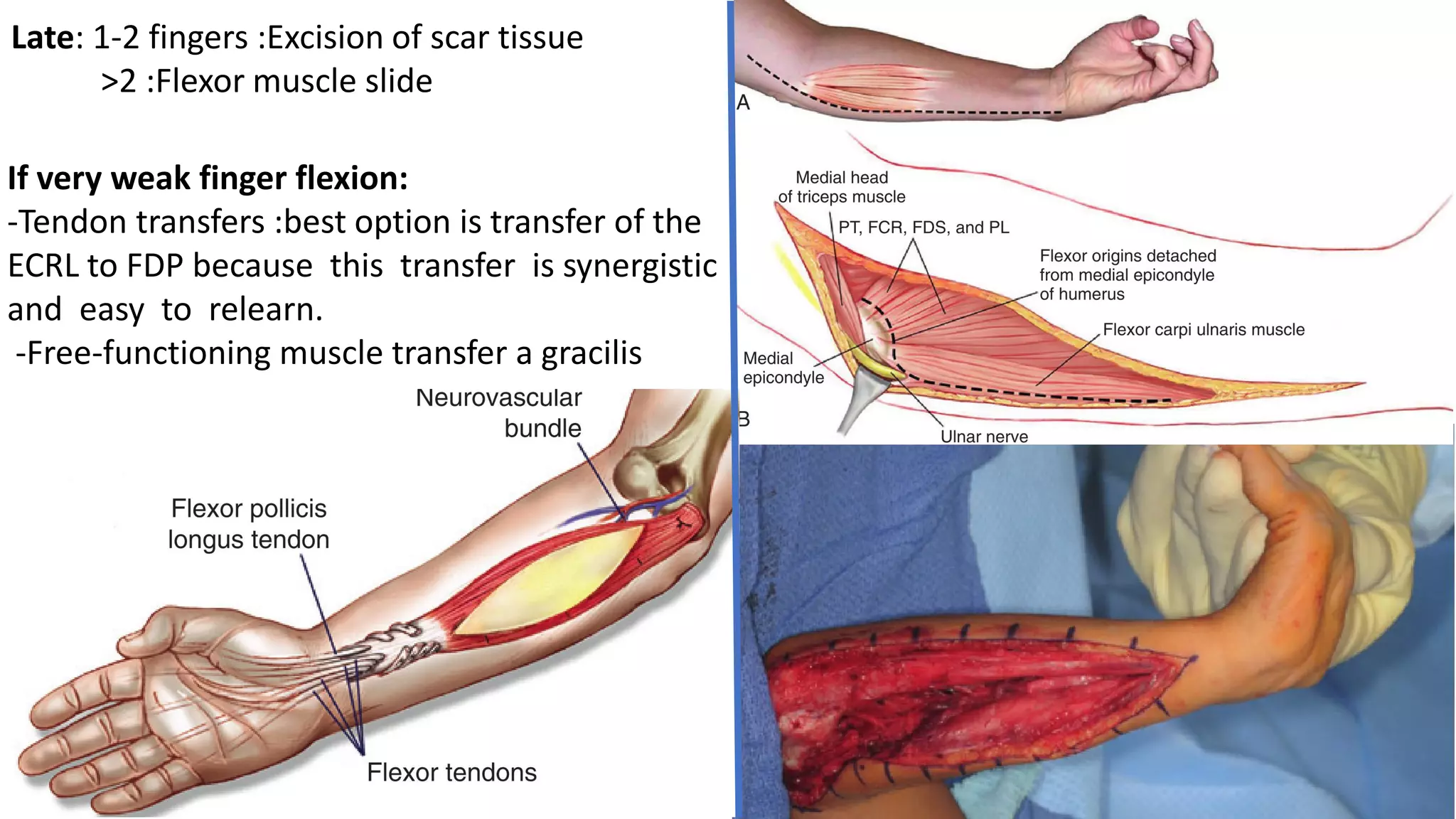 Hand deformities upload | PDF