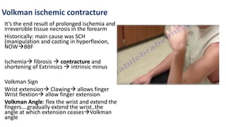 Hand deformities upload | PDF