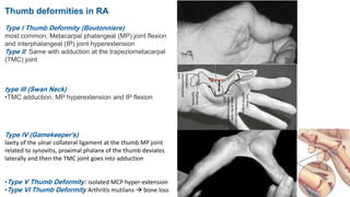 Hand deformities upload | PDF