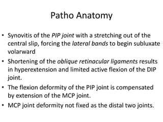 Hand deformity in rheumatoid arthritis | PPTX