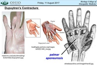 Hand Disorders.ppt